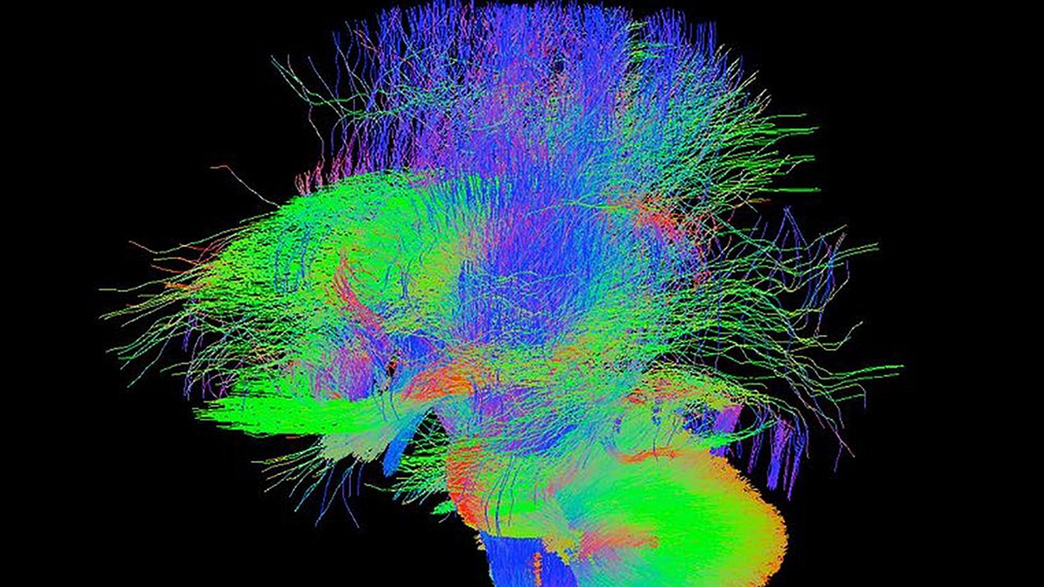 Baby brain maps point to origins of neurological disorders